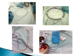 Kateterisasi jantung | PPTX