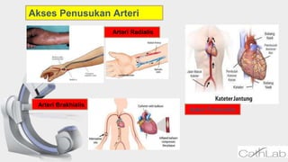 KATETERISASI JANTUNG.pptx