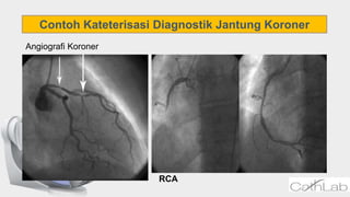 KATETERISASI JANTUNG.pptx