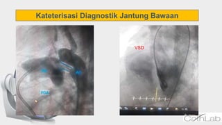 KATETERISASI JANTUNG.pptx