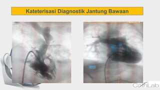 KATETERISASI JANTUNG.pptx