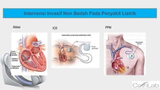 KATETERISASI JANTUNG.pptx