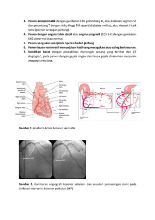 Kateterisasi jantung koroner | PDF