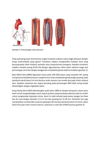 Kateterisasi jantung koroner | PDF
