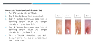 Kateter vena central (central vein catheter) - debs.pptx