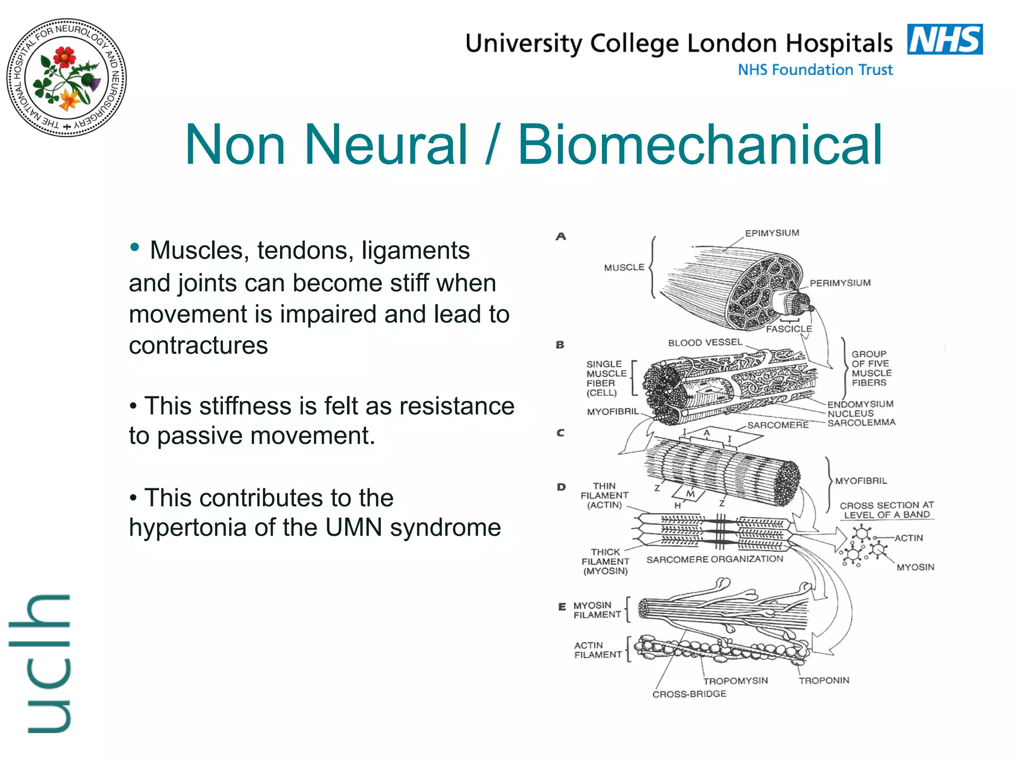 Katrina Buchanan - Spasticity Management in MS: A team approach | PDF