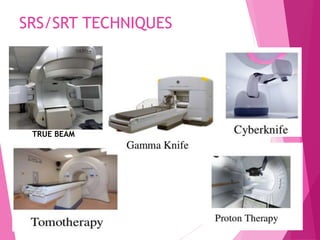 Katya srs and srt | PPT