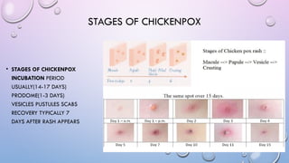kavi infectious.pptx,etiology,pathophysiology | PPT