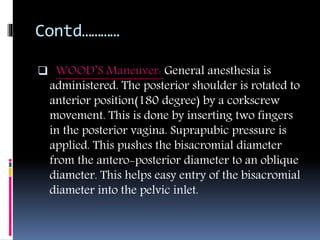 shoulder dystocia | PPTX