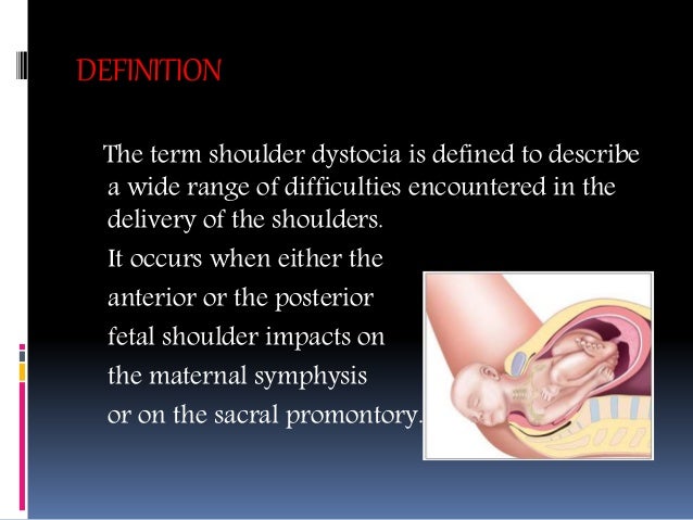shoulder dystocia