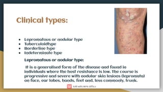 Morphology, laboratory diagnosis of Mycobacterium leprae | PPT