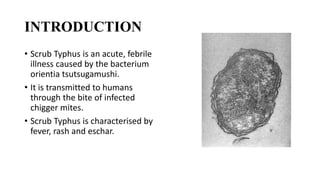 Srub typhus department of microbiology.pptx