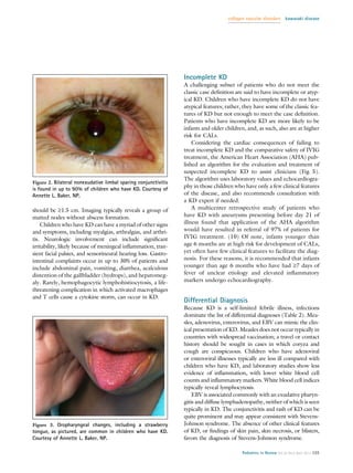 Kawasaki disease | PDF