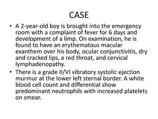 Kawasaki disease | PPTX