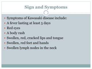 Kawasaki disease.. | PPTX
