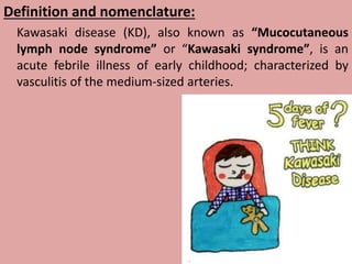 Kawasaki disease | PPTX