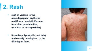 Kawasaki disease | PPTX