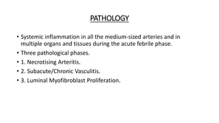 Kawasaki disease aha guidlines | PPTX