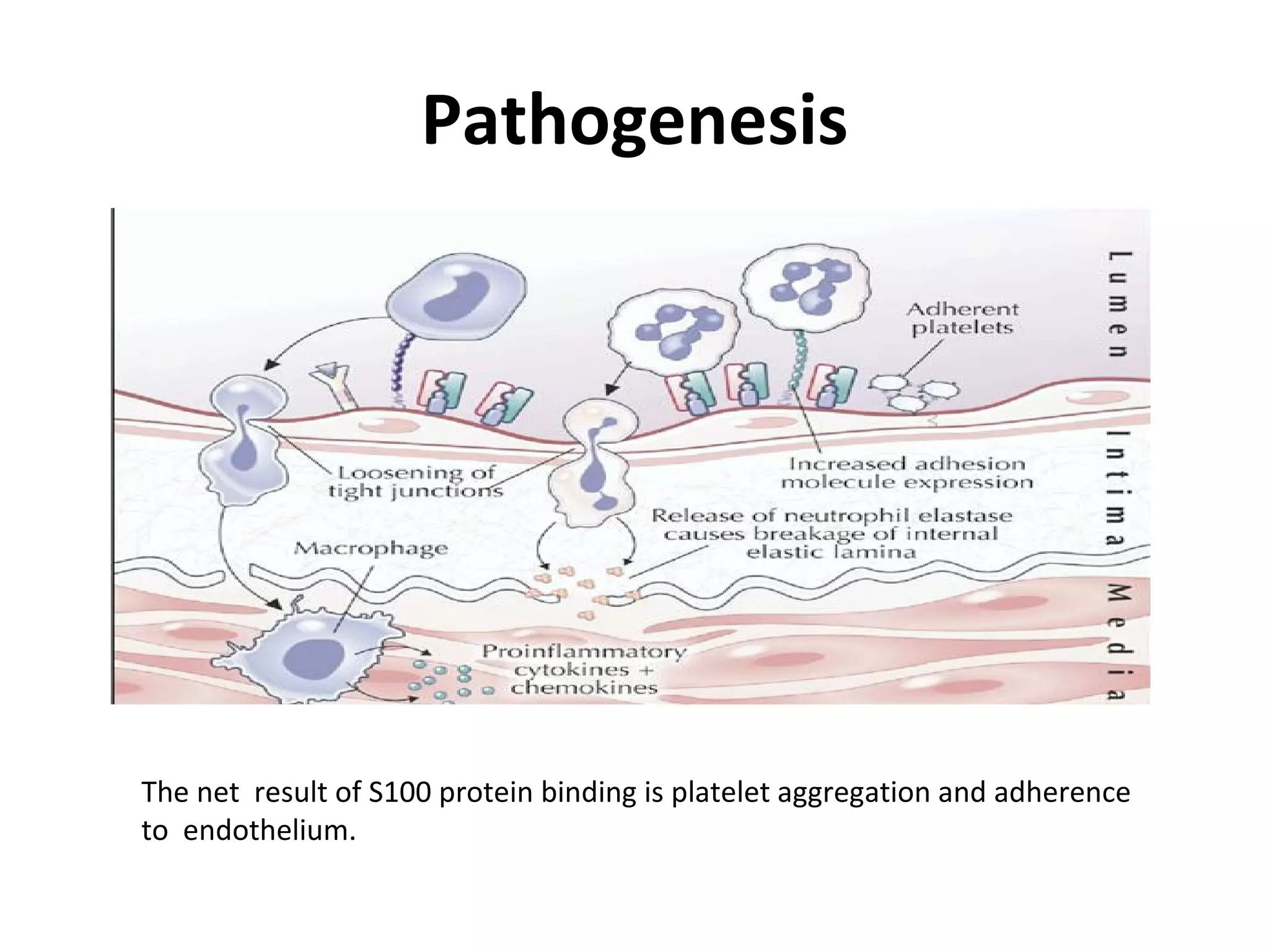 Kawasaki disease (kd) 2 | PPT