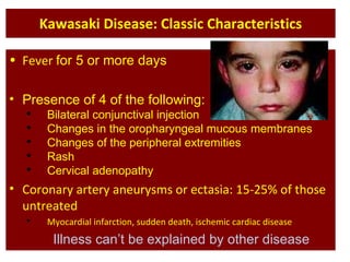 Kawasaki disease (kd) 2 | PPT
