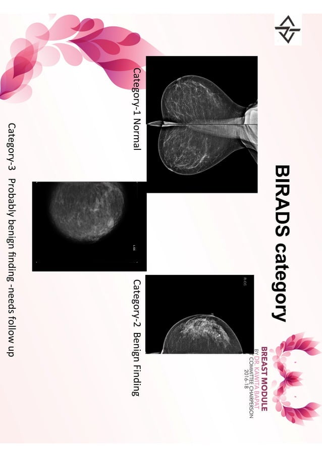 Kawita bapat lumps and bumps breast | PPT