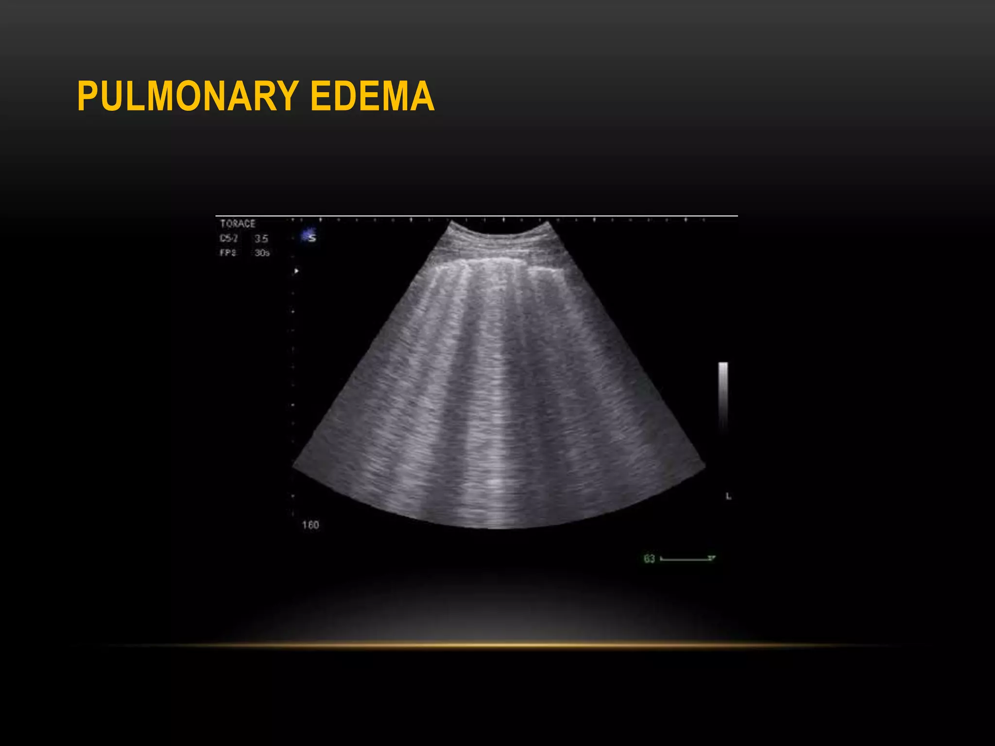 Chest ultrasound.pptx