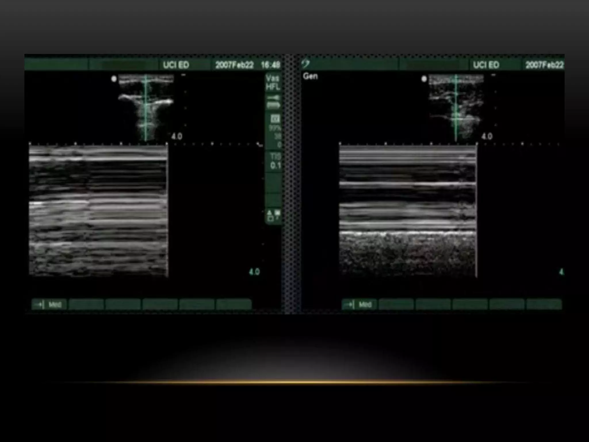 Chest ultrasound.pptx