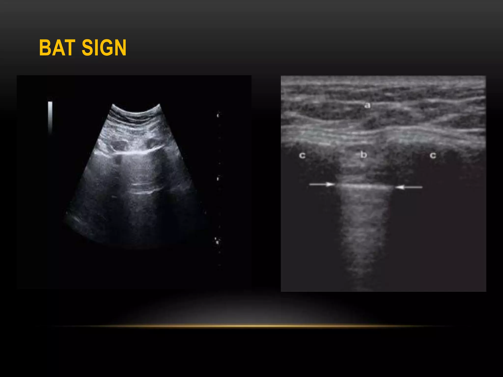 Chest ultrasound.pptx