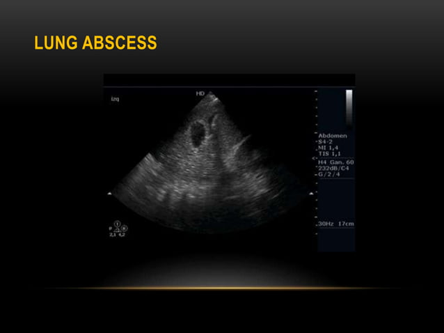 Chest ultrasound.pptx