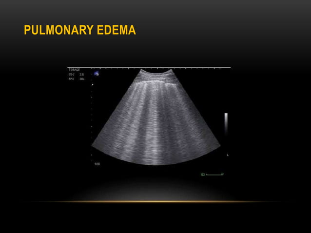 Chest ultrasound.pptx