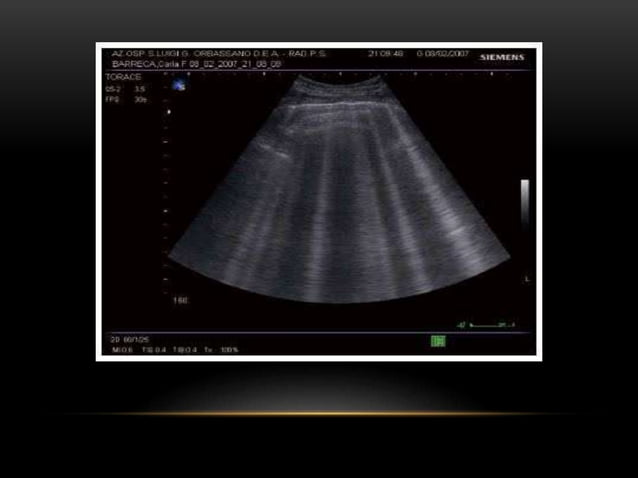 Chest ultrasound.pptx