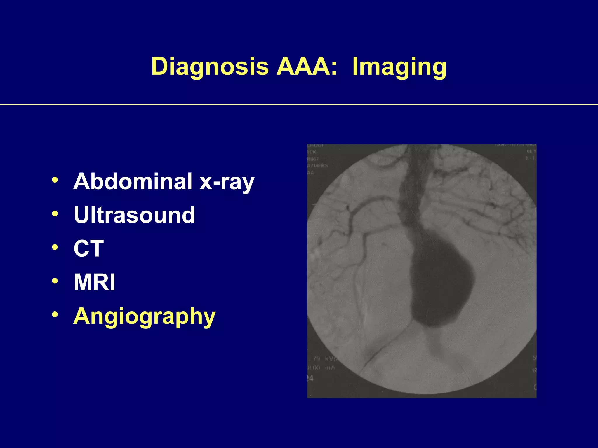 Abdominal Aortic and Thoracic Aneurysms | PPT