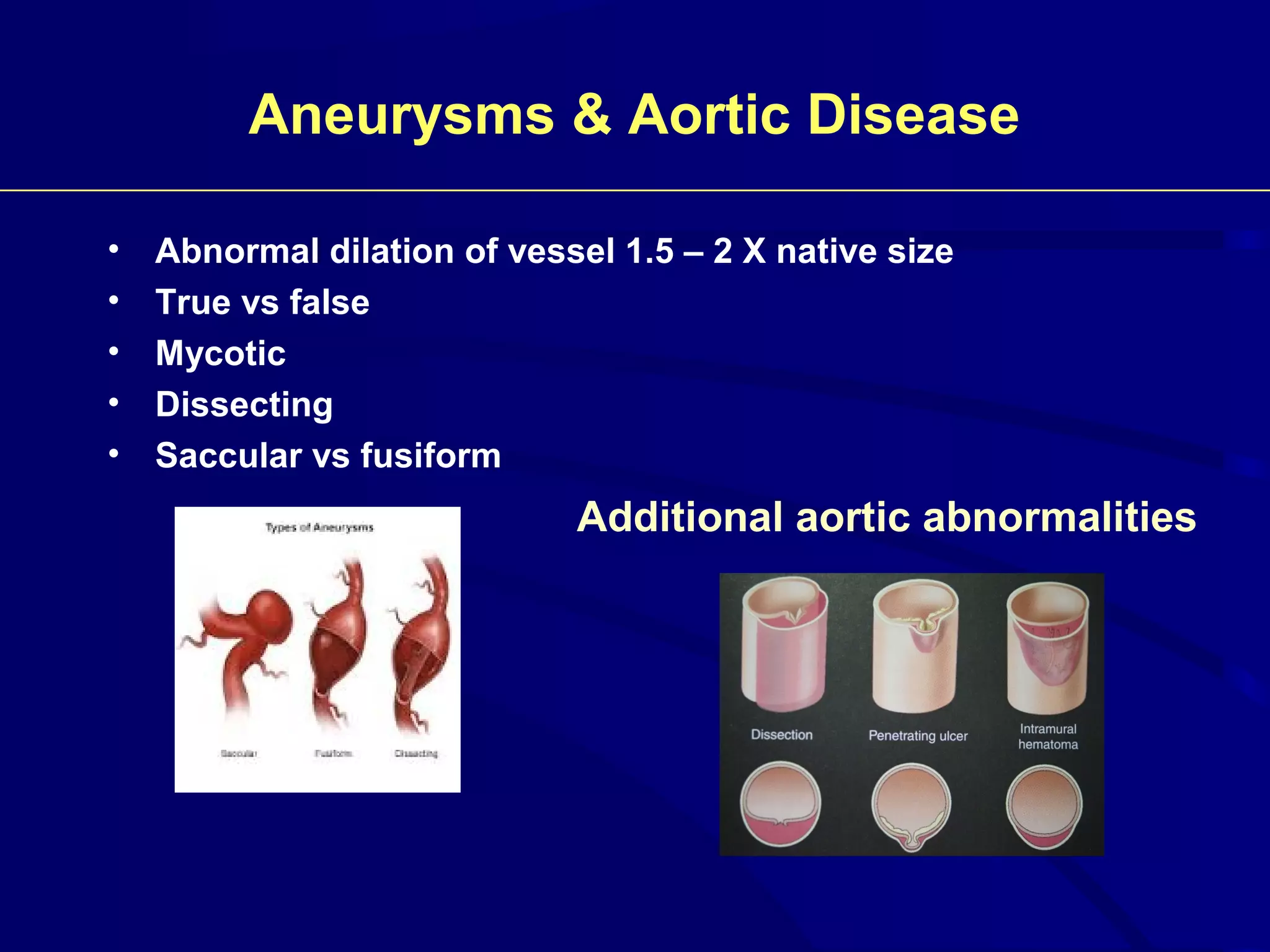 Abdominal Aortic and Thoracic Aneurysms | PPT