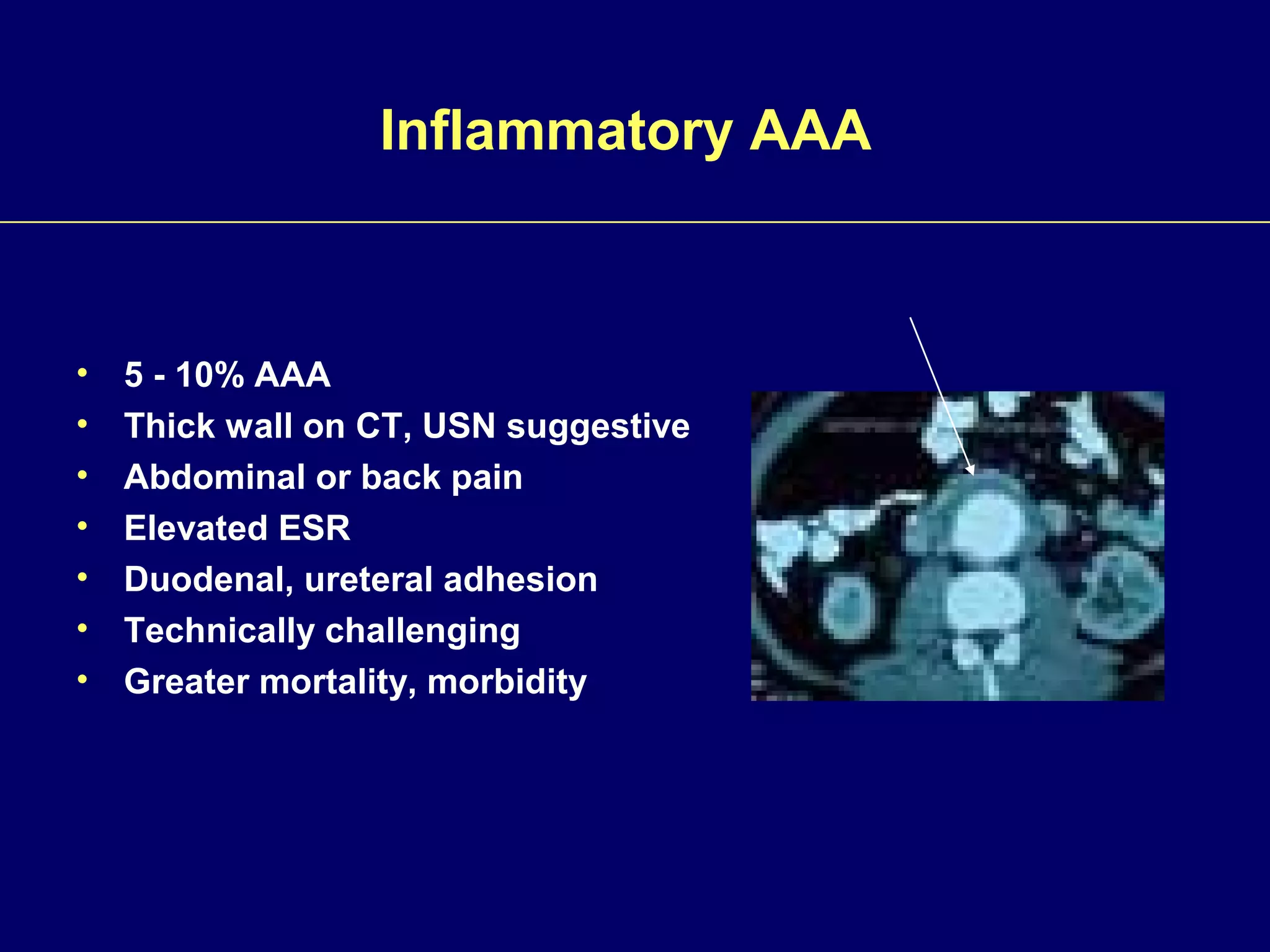 Abdominal Aortic and Thoracic Aneurysms | PPT