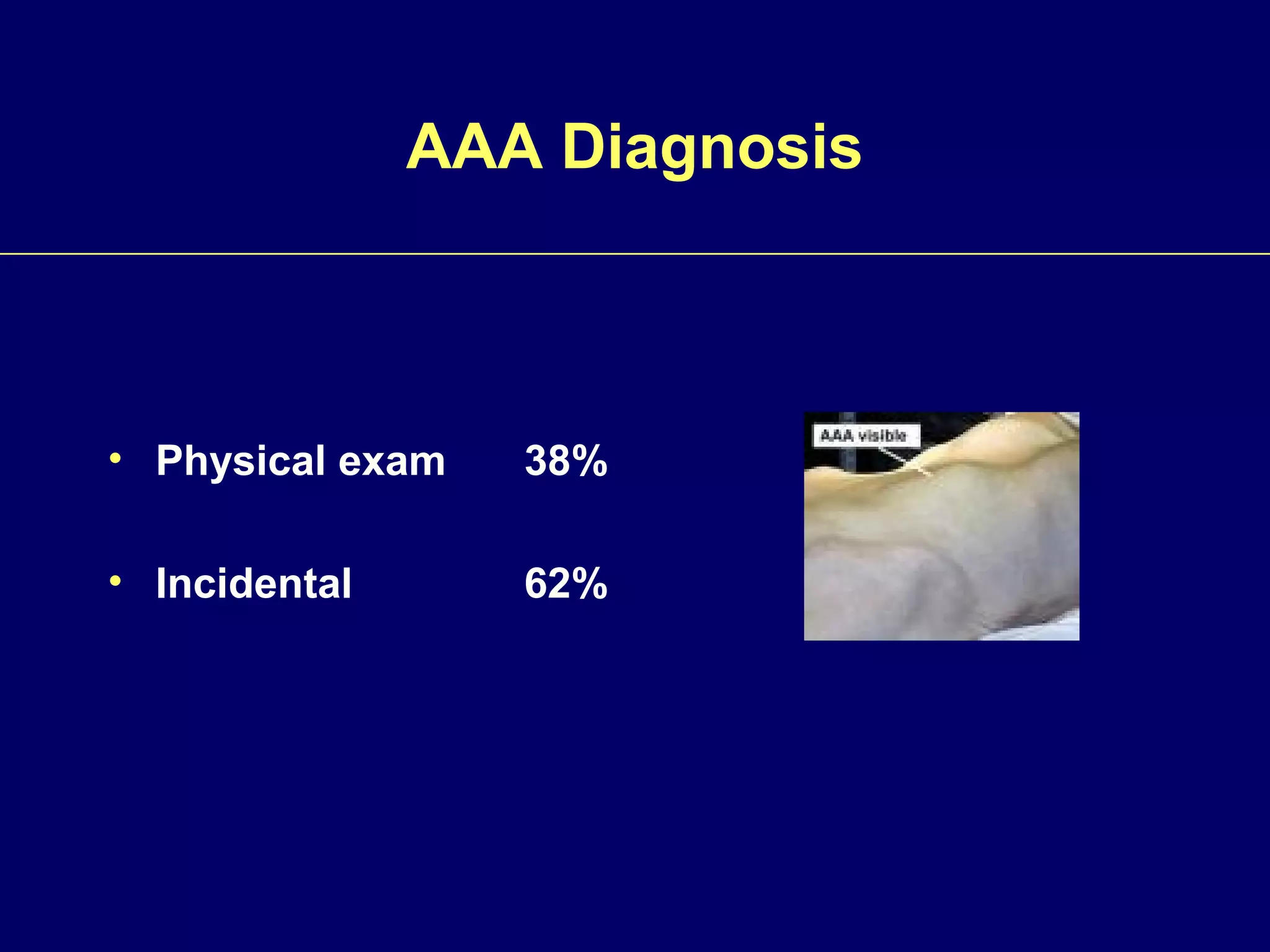 Abdominal Aortic and Thoracic Aneurysms | PPT