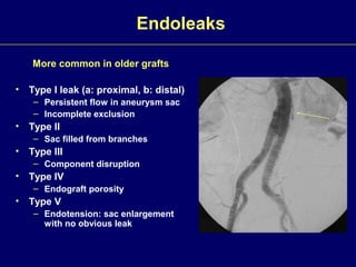 Abdominal Aortic and Thoracic Aneurysms | PPT