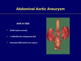Abdominal Aortic and Thoracic Aneurysms | PPT
