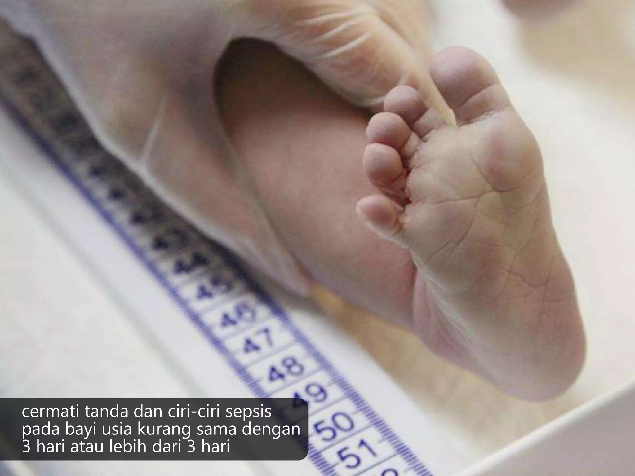 Kb 1 konsep dasar pencegahan infeksi pada neonatus dan bayi | PPTX