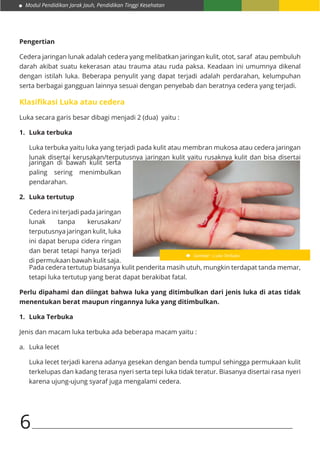 KB 1 Penanganan Luka atau Cedera | PDF