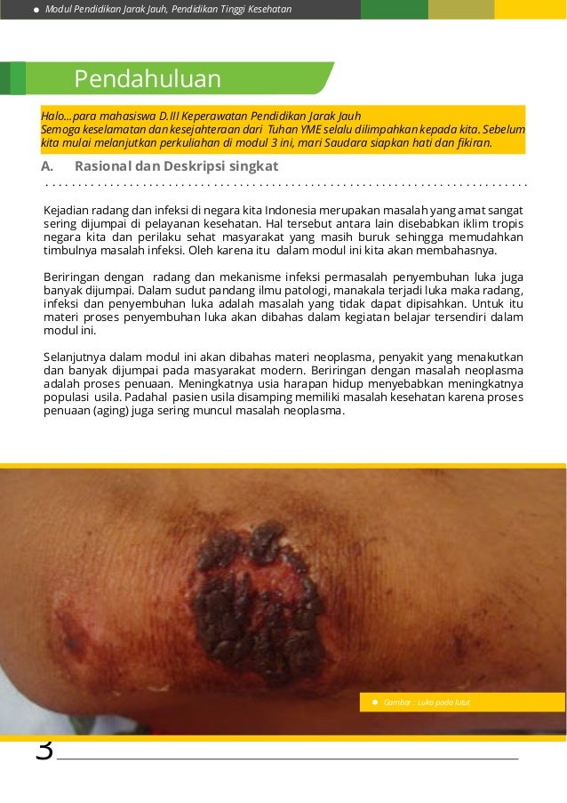 Radang dan mekanisme proses Infeksi