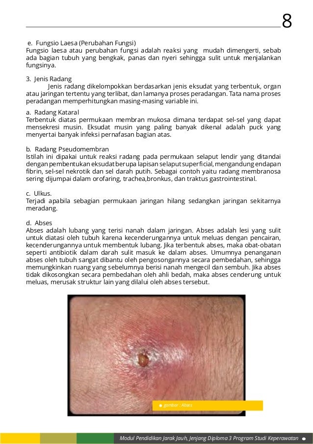 Radang dan mekanisme proses Infeksi