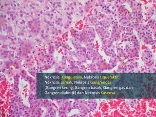 Tahap kematian jaringan dan | PPTX