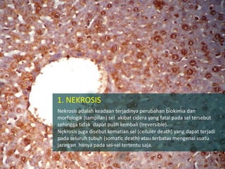 Tahap kematian jaringan dan | PPTX