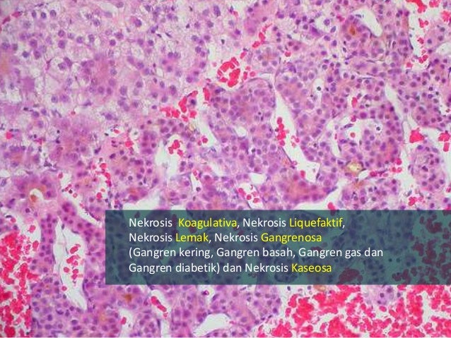 Tahap kematian jaringan dan