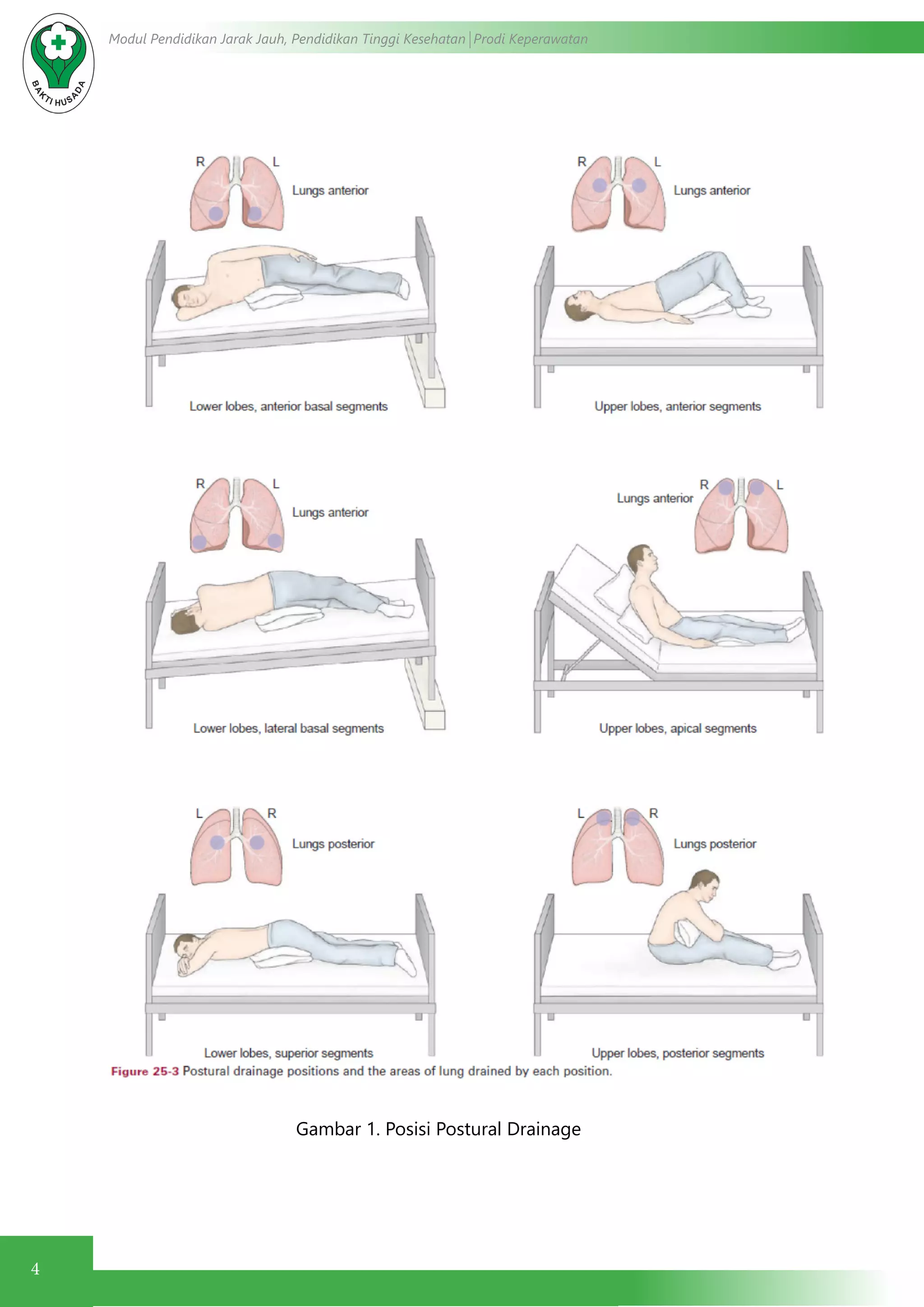 Postural Drainage | PDF