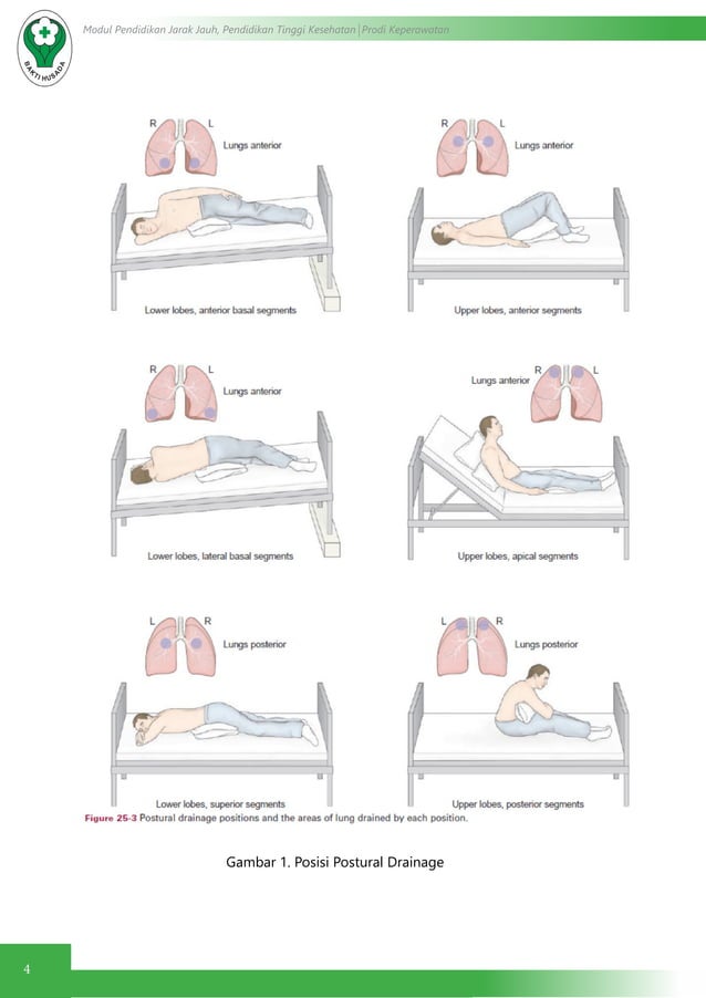 Postural Drainage | PDF