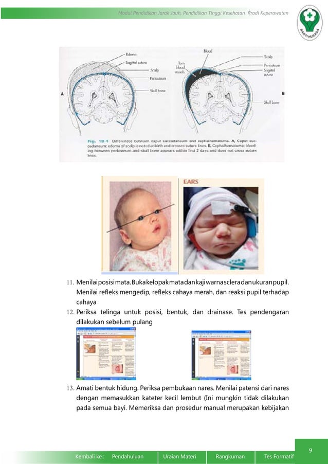 Konsep dasar dan asuhan keperawatan bayi baru lahir (BBL) | PDF