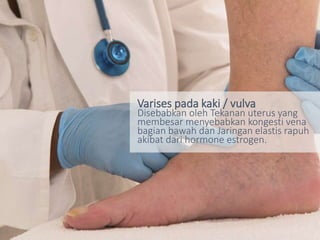 Kb3 ketidaknyamanan pada ibu hamil dan cara mengatasinya | PPTX