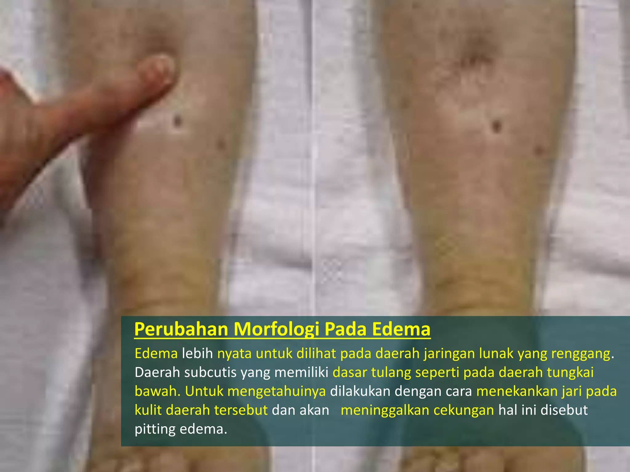 Kelainan sirkulasi, cairan tubuh dan asam basa | PPTX