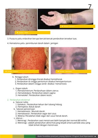 Kb 3 kelaianan sirkulasi, cairan tubuh | PDF